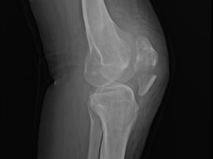 Ottawa Knee Rules – John Snyder, DPT